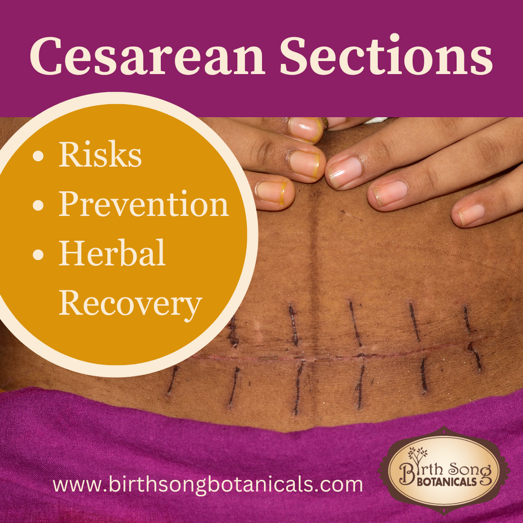 Cesarean Sections: Risks, Prevention, and Herbs for Recovery– Birth ...